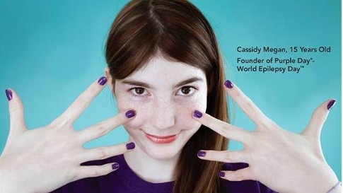 Znate li kako pomoći osobi koja ima epileptički napad?